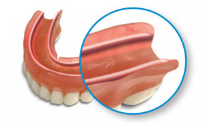 Lower Denture Snug-Up Application – Densurefit.com