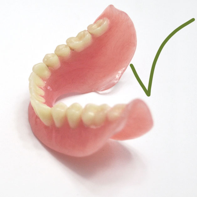 Can DenSureFit be used on a Lower Denture? – Densurefit.com